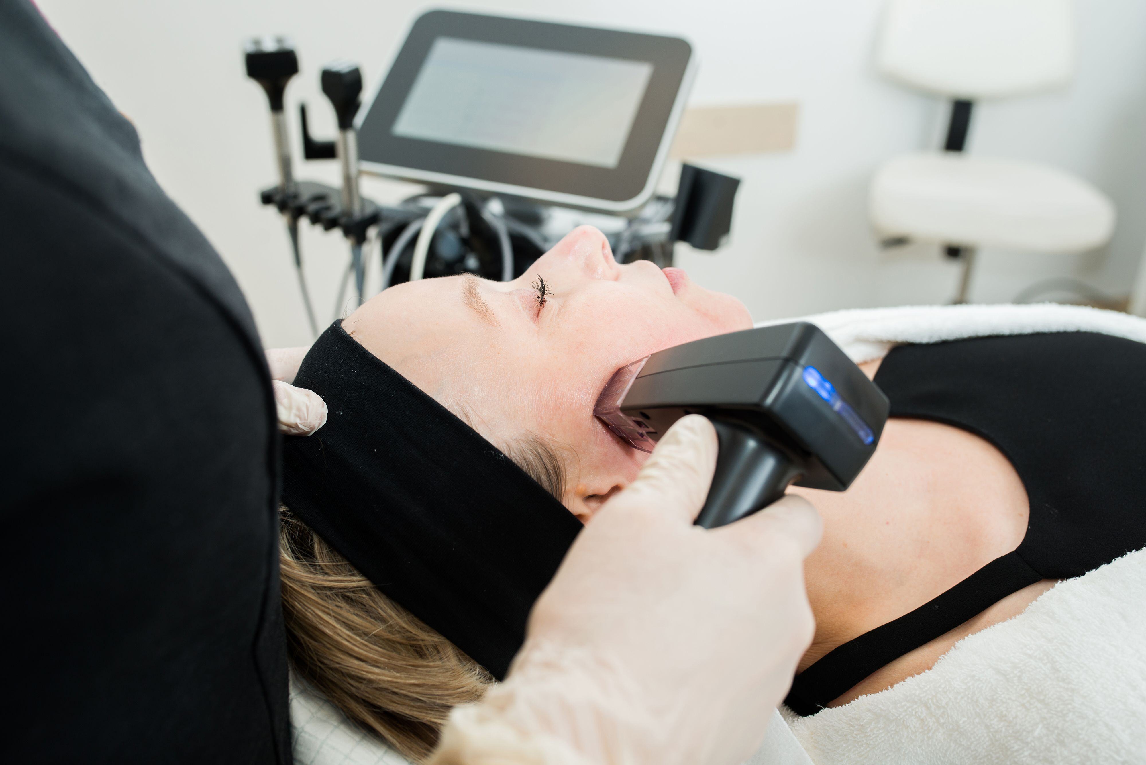 Morpheus 8 Before and After [Real Photos Included]